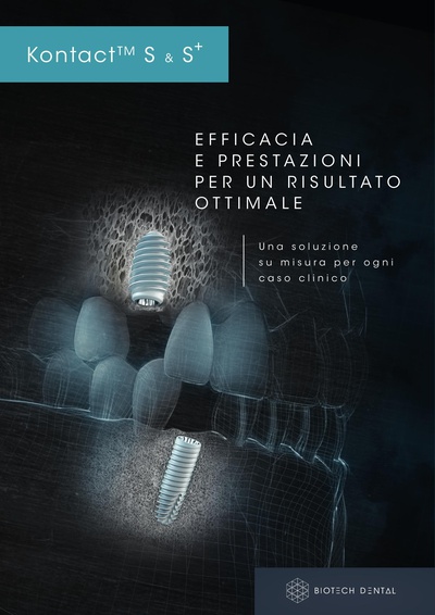 Biotech Dental Kontact S Dental Implant | SpotImplant
