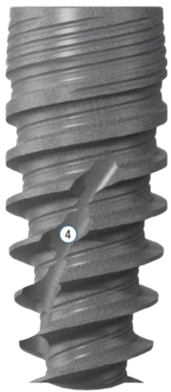 GMI (Global Medical Implants) Frontier PEAK Dental Implant | SpotImplant