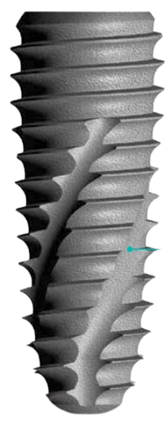 Cowellmedi Inno Internal Dental Implant | SpotImplant