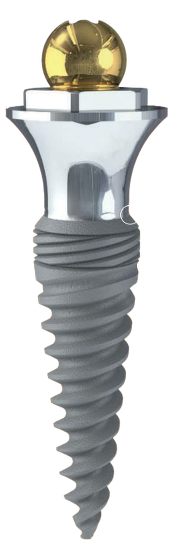 Eckermann Implants dentaires | SpotImplant