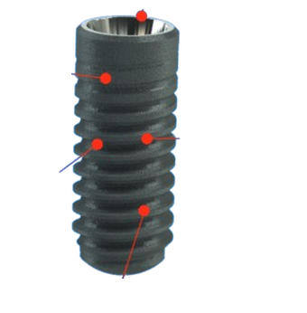 Novamind Dental Implants | SpotImplant