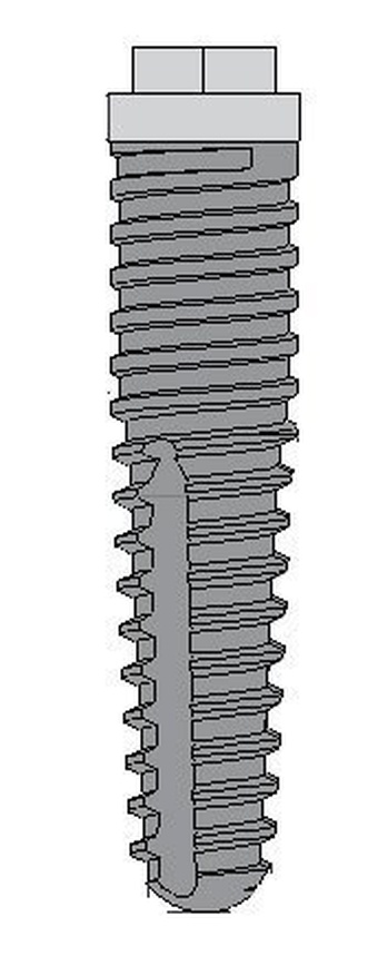 Southern Implants External Hex (Tapered) Dental Implant | SpotImplant