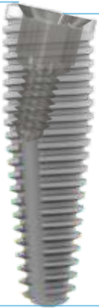 Southern Implants Promax Dental Implant | SpotImplant