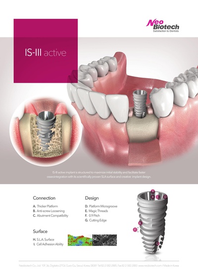 Neobiotech Dental Implants | SpotImplant