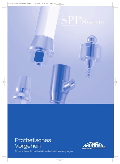 Thommen SPI Contact (Flared Head) Dental Implant | SpotImplant