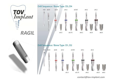 TOV Implant Dental Implants | SpotImplant