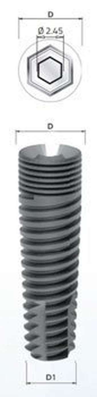 FDS76 K2 wide threads Dental Implant | SpotImplant