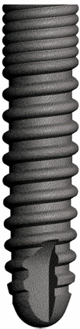 Zuga Dental Implants | SpotImplant