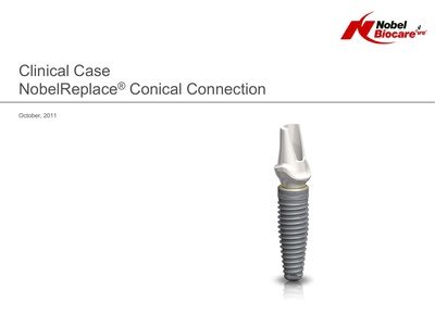 Nobel Biocare NobelReplace CC (Conical Connection) PMC Dental Implant ...