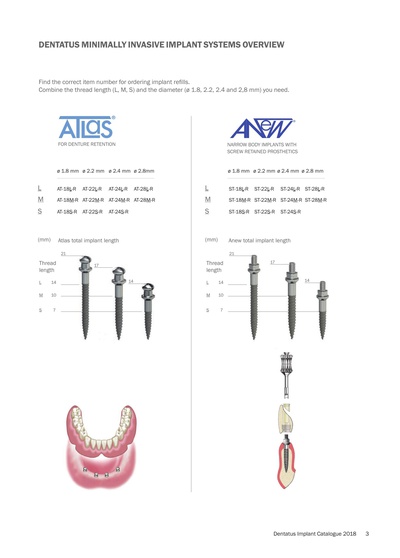 Dentatus Atlas Implant dentaire | SpotImplant
