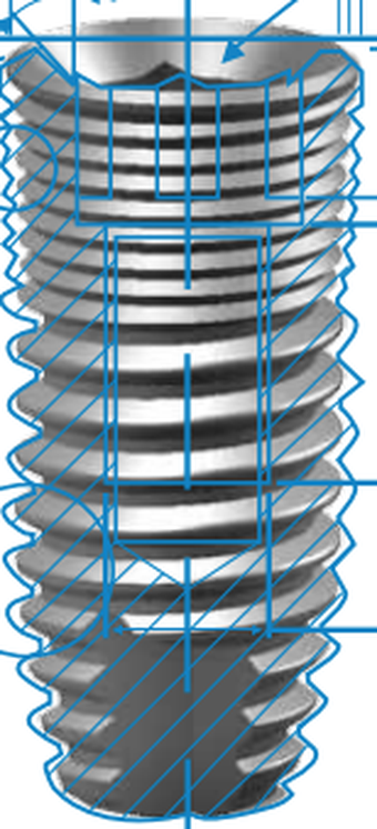 Medibrex Dental Implants | SpotImplant