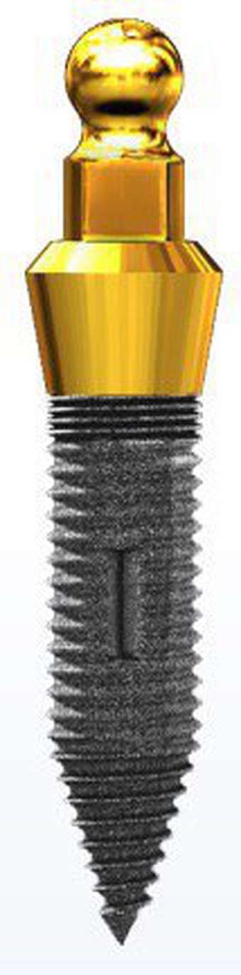 OCO Biomedical Dental Implants | SpotImplant