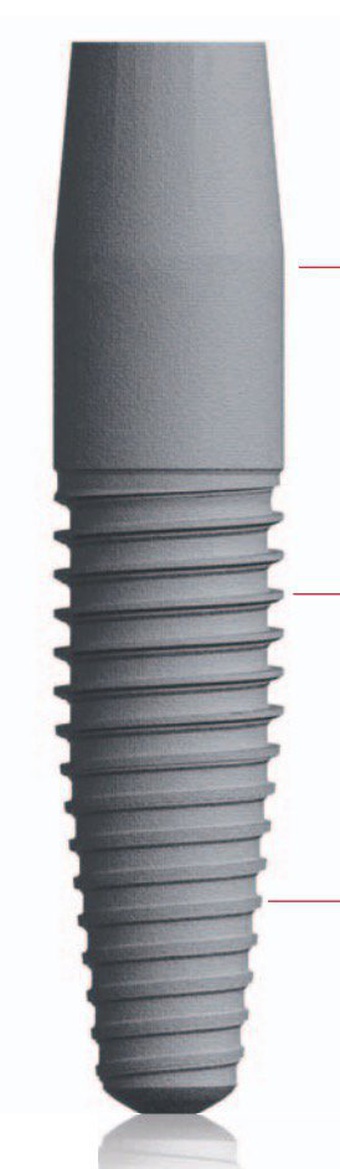 Nobel Biocare NobelReplace CC (Conical Connection) Dental Implant ...