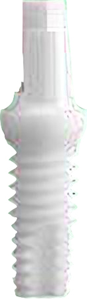 Z-Systems Dental Implants | SpotImplant