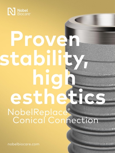 Nobel Biocare NobelReplace CC (Conical Connection) Dental Implant ...