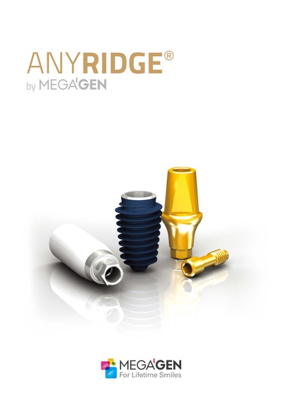 Megagen Anyridge Special 7mm Dental Implant | SpotImplant