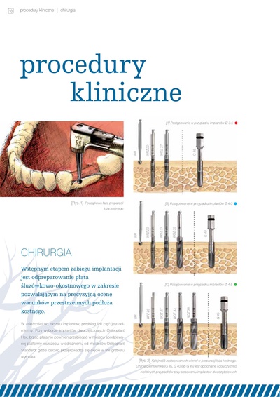 Osteoplant Dental Implants | SpotImplant