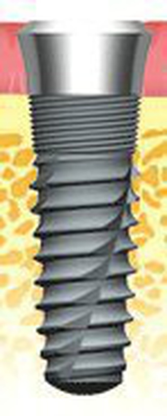 Cowellmedi Atlas Internal Straight Dental Implant | SpotImplant