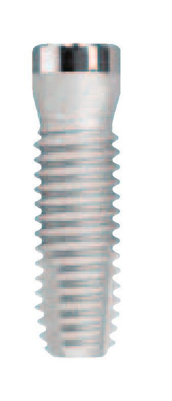 Keystone Dental (Lifecore Biomedical) Dental Implants | SpotImplant