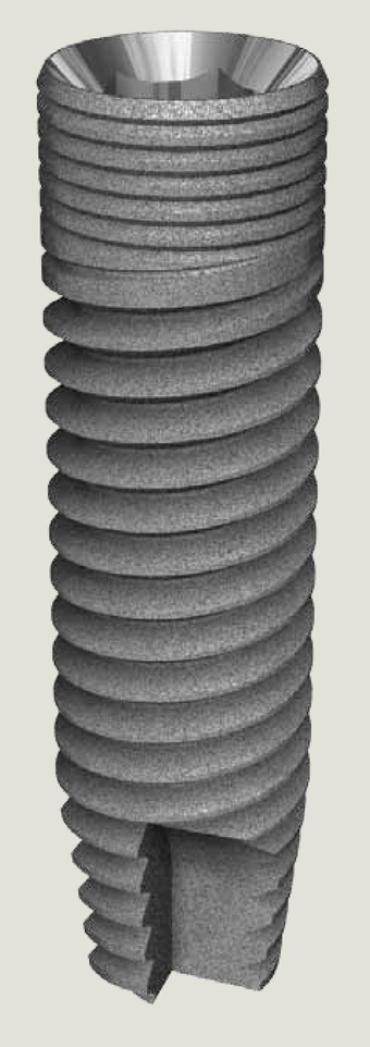 DENTIN Implants Technologies Dental Implants | SpotImplant