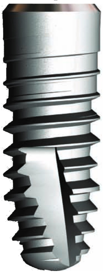 Dyna Dental Implantes dentales | SpotImplant