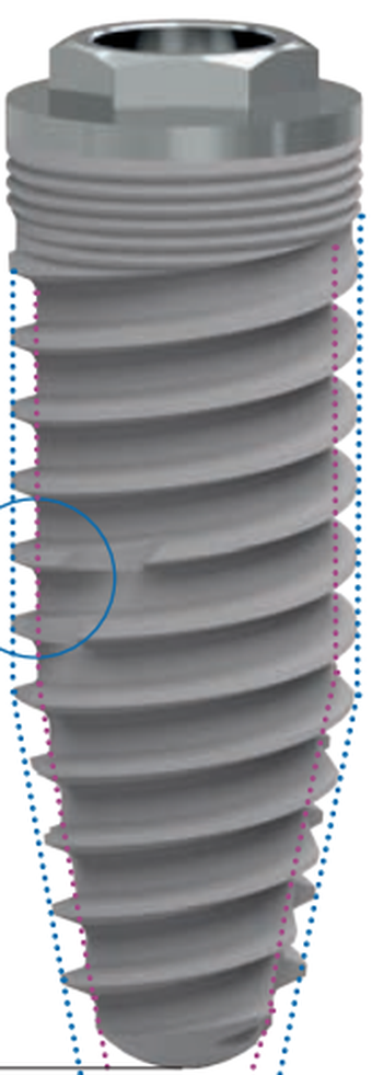 Ziacom / Osseolife Dental Implants | SpotImplant