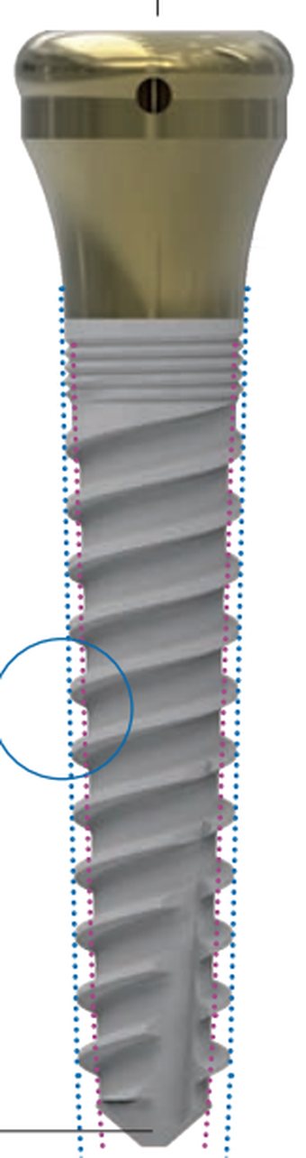 Ziacom / Osseolife Dental Implants | SpotImplant