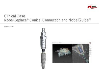 Nobel Biocare NobelReplace CC (Conical Connection) Dental Implant ...