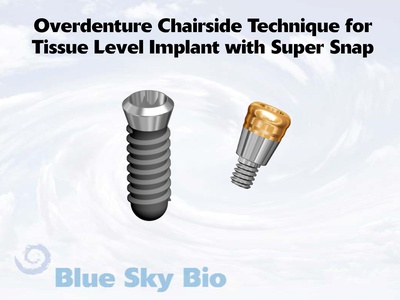 Blue Sky Bio Dental Implants | SpotImplant