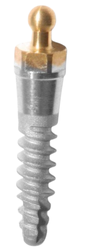 Safe & Simple Dental Implants | SpotImplant