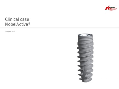 Nobel Biocare NobelActive Implant dentaire | SpotImplant