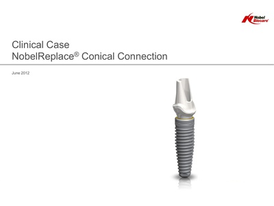 Nobel Biocare NobelReplace CC (Conical Connection) PMC Dental Implant ...