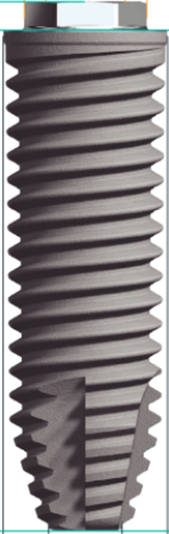 Tree-Oss Dental Implants | SpotImplant