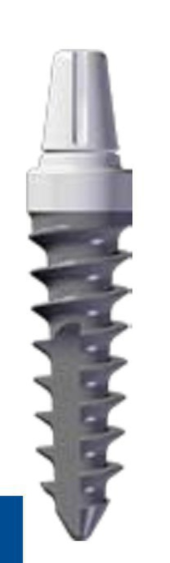 Trinon Titanium Dental Implants | SpotImplant