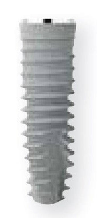 Dentsply Sirona IMZ TwinPlus Cylinder Zahnimplantat | SpotImplant