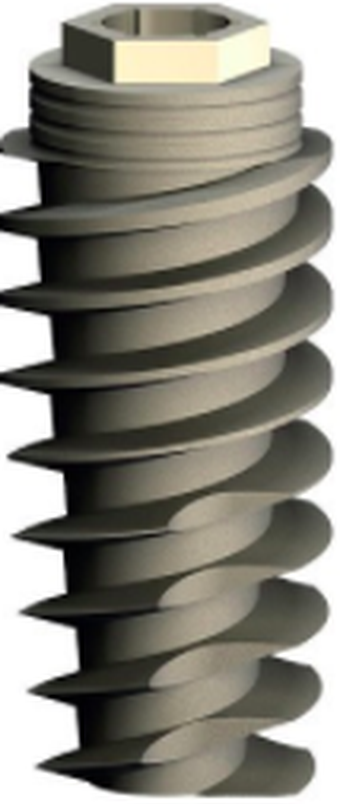 Gi Esse Technology Conus Dental Implant | SpotImplant