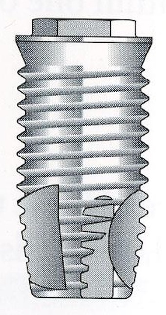 Nobel Biocare NobelParallel CC (Conical Connection) Dental Implant ...