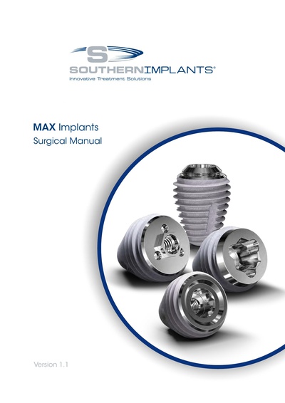 Southern Implants Promax Dental Implant | SpotImplant