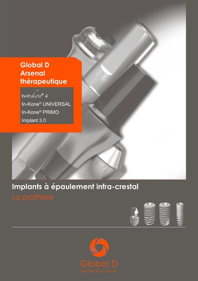 GlobalD Dental Implants | SpotImplant