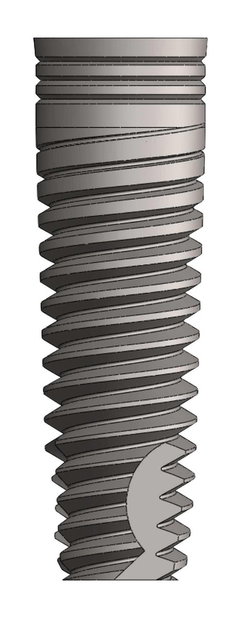 IQ Implants Dental Implants | SpotImplant