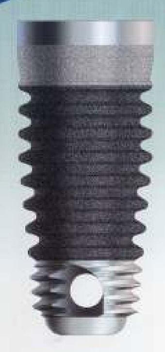 Paragon Dental Implants | SpotImplant