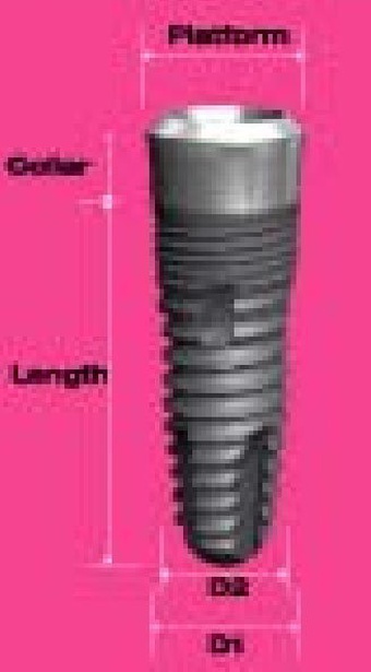DIO Implant Dental Implants | SpotImplant