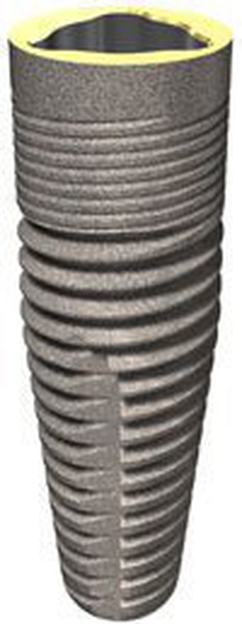 Implant Direct Legacy 3 Dental Implant | SpotImplant