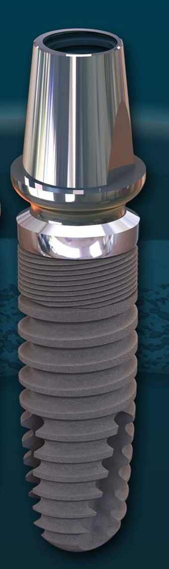 Eckermann All Spiral Dental Implant | SpotImplant
