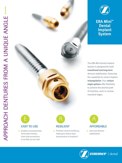 Zimmer Dental Implants | SpotImplant
