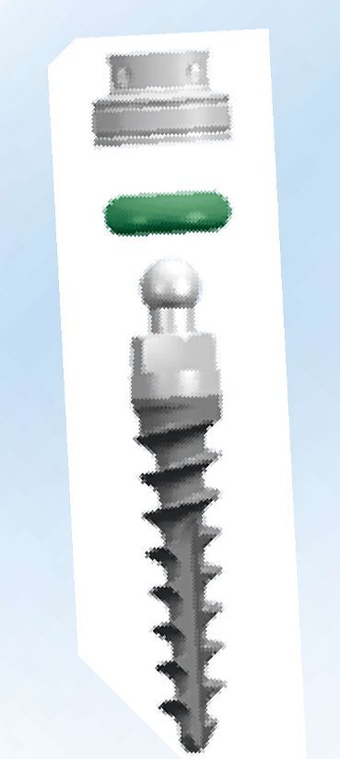 Trinon Titanium QZA Dental Implant | SpotImplant