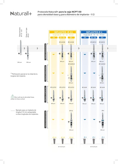 ETK (Euroteknika) Dental Implants | SpotImplant