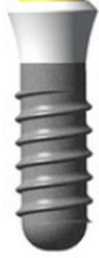 Dental Implant Features | SpotImplant