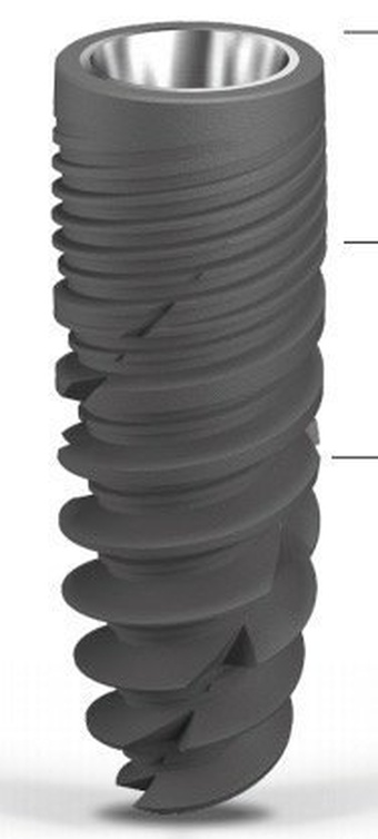 Spotimplant | Dental Implant search engine and identification service