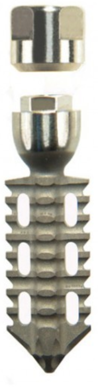 Tecom Implantology Dental Implants | SpotImplant